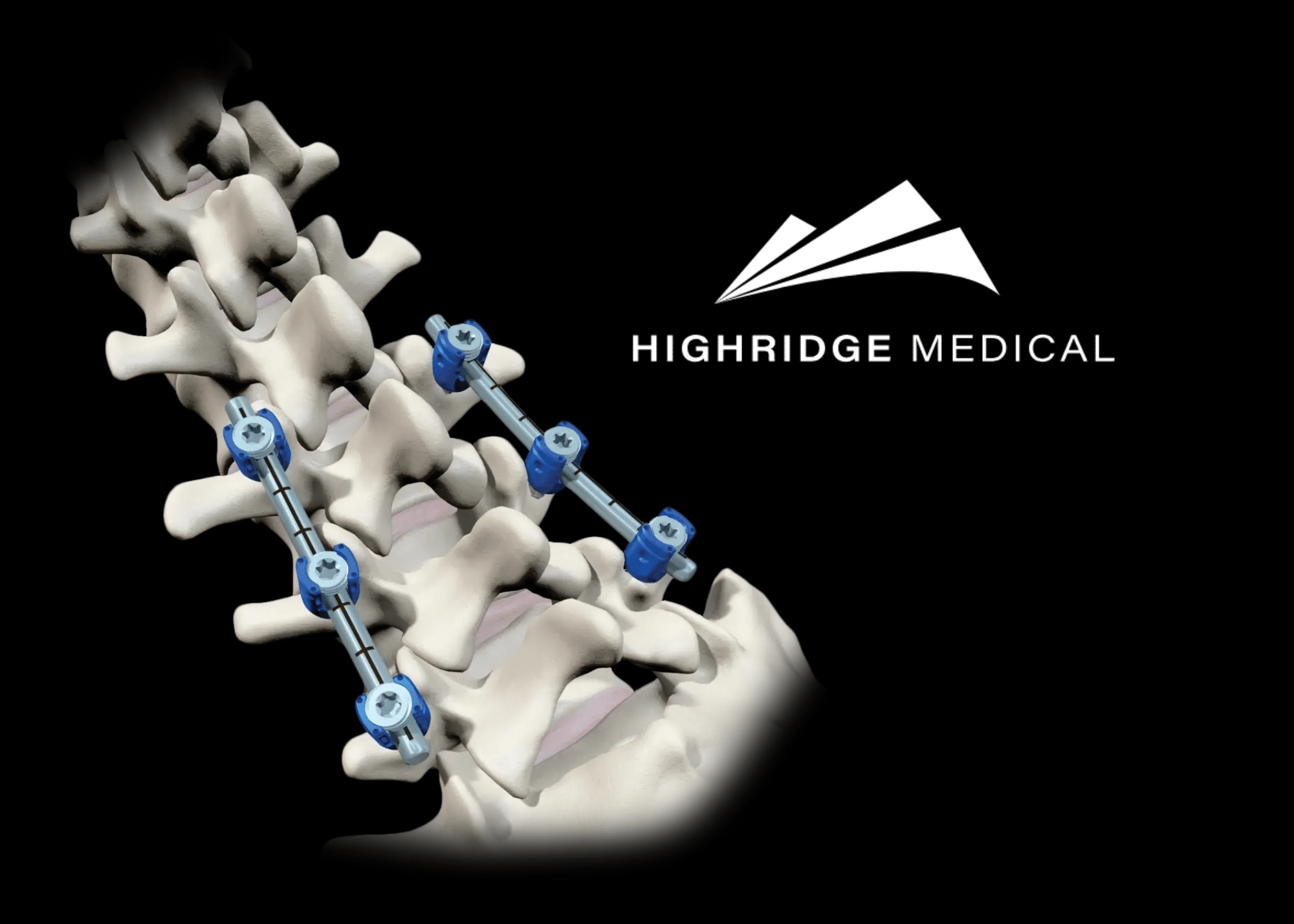 Highridge Medical Acquires Innovative Products from Accelusto Expand ...